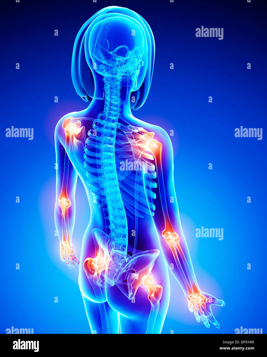 Joint pain, artwork Stock Photo - Alamy