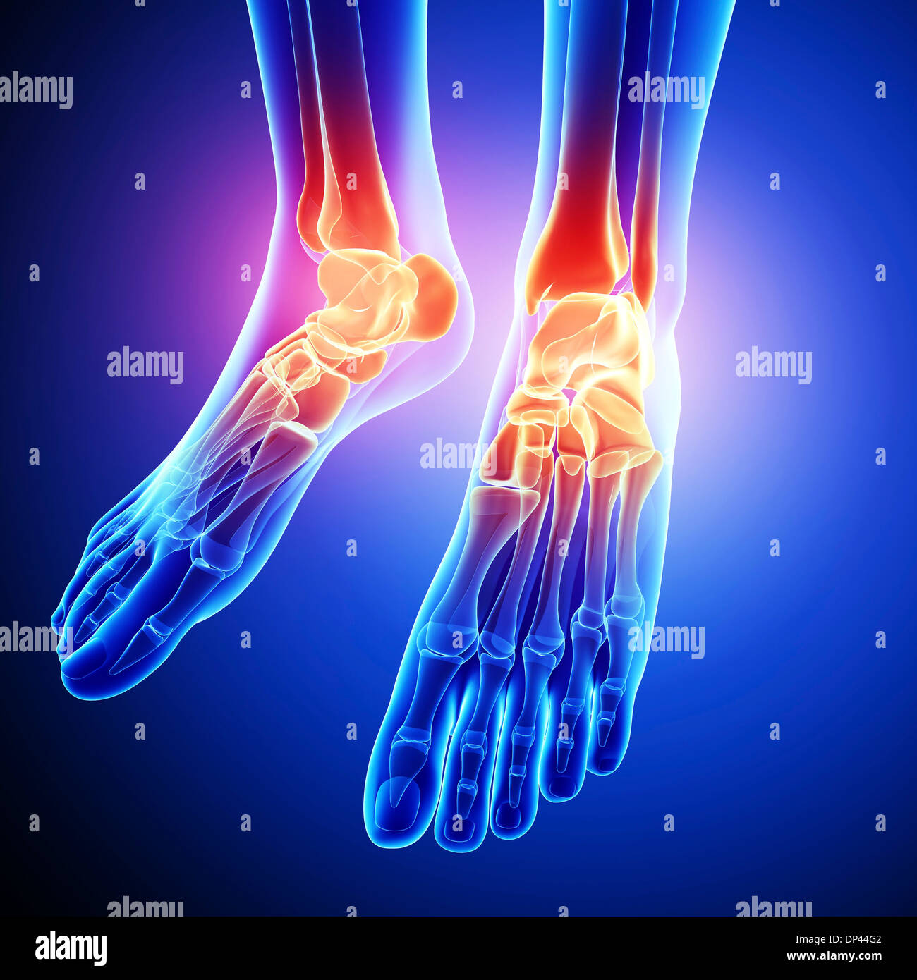 Foot pain, artwork Stock Photo - Alamy