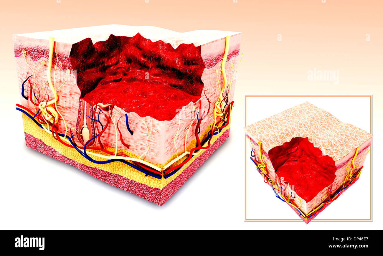 Human skin anatomy, artwork Stock Photo - Alamy
