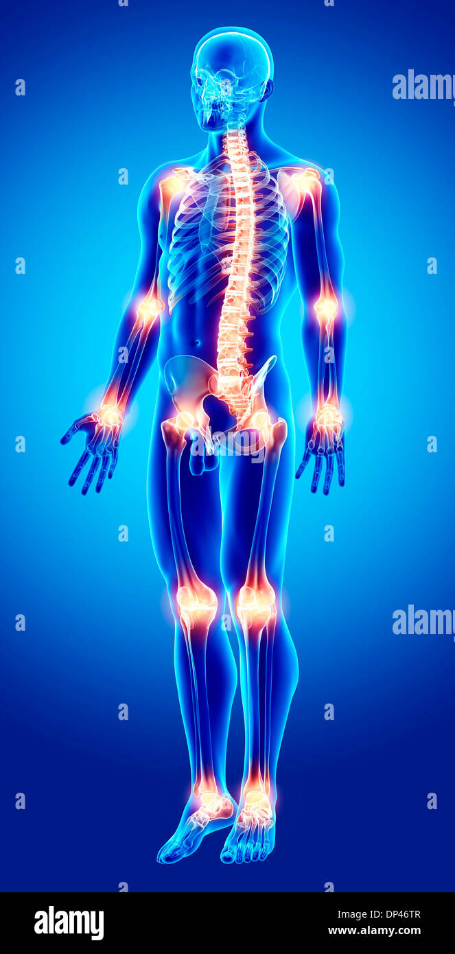 Joint pain, artwork Stock Photo - Alamy