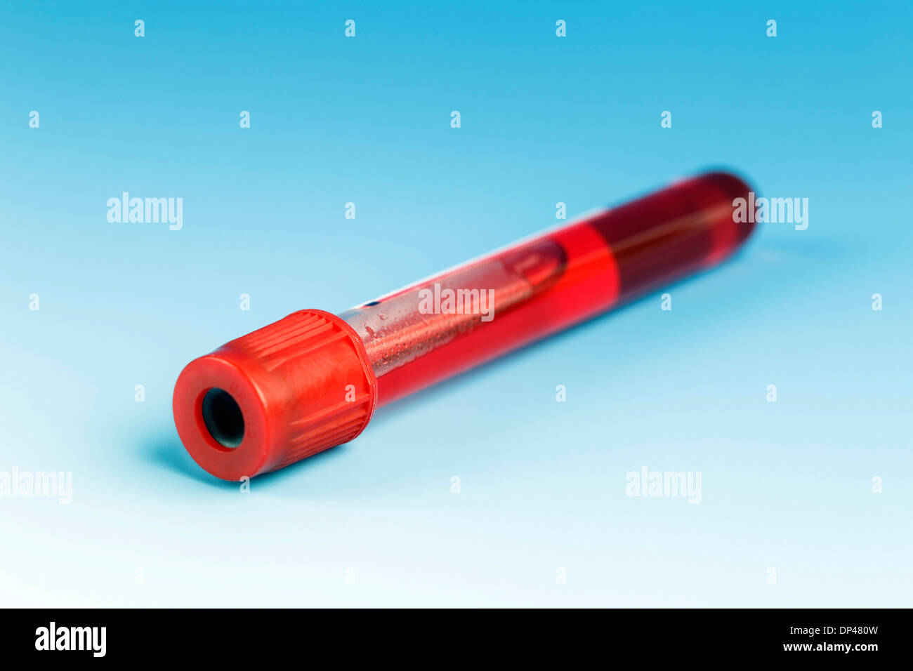 Single blood sample hi-res stock photography and images - Alamy