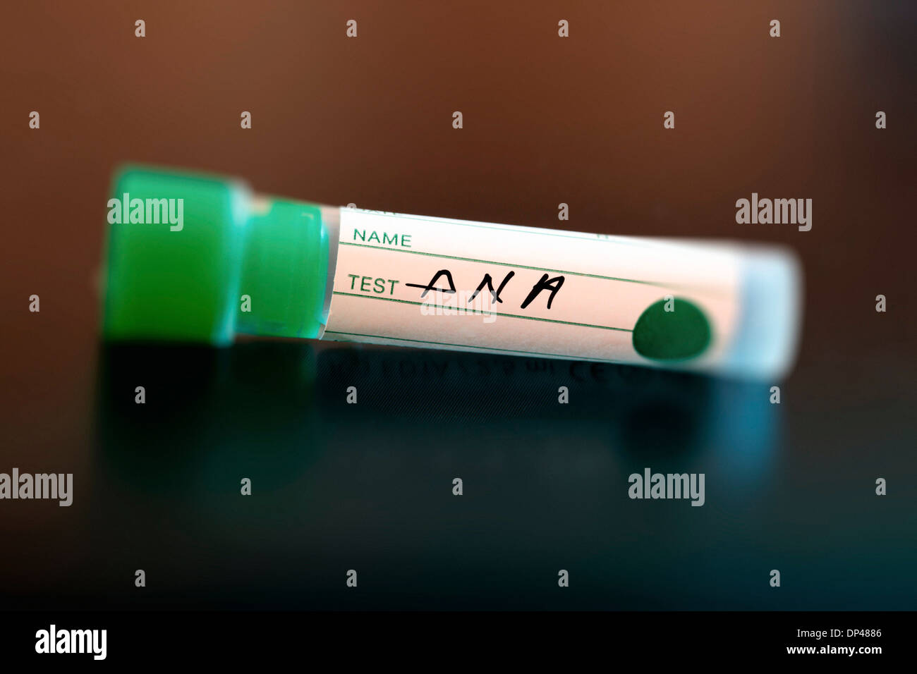 DNA sample tube Stock Photo - Alamy