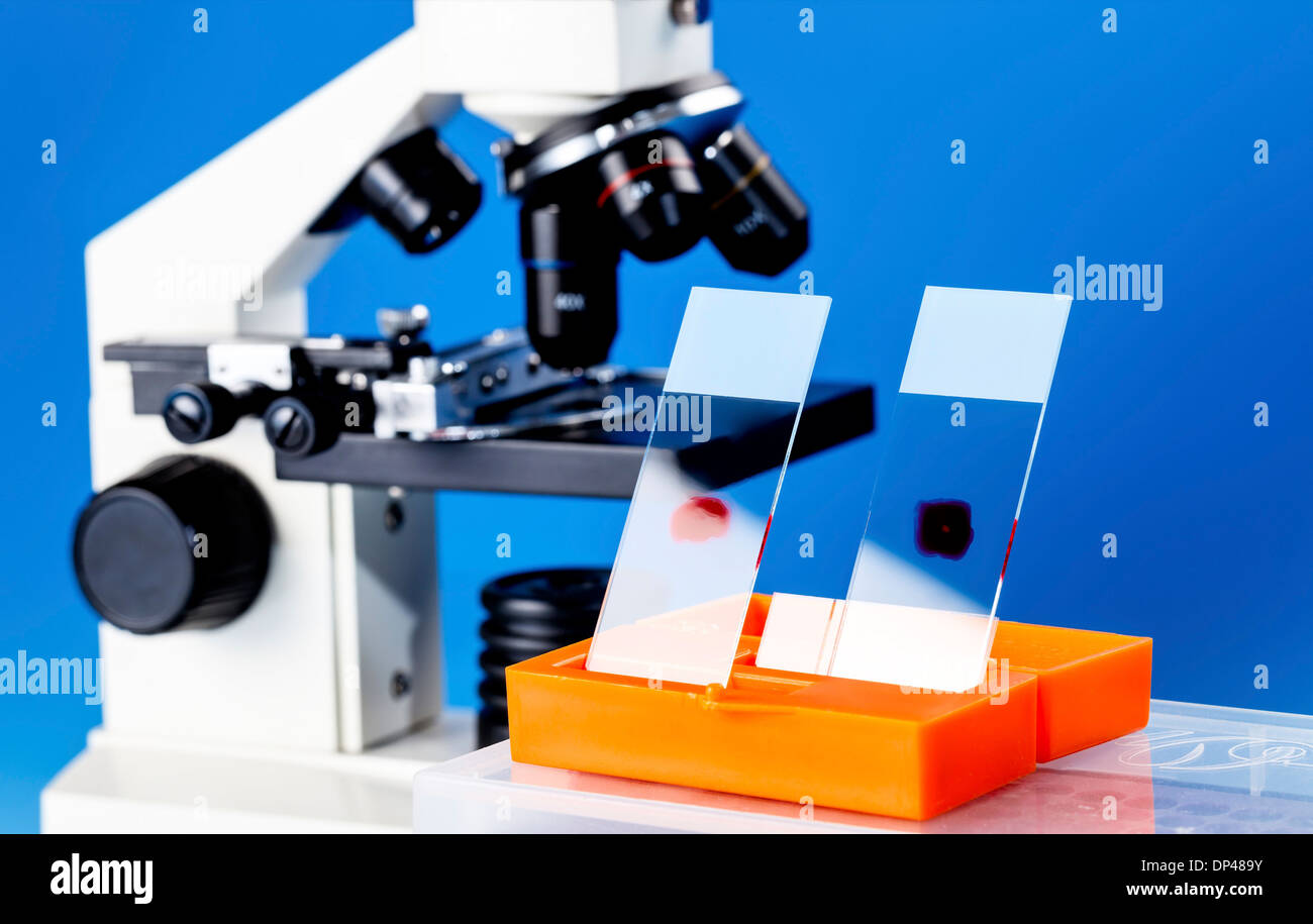 Blood smear microscope hi-res stock photography and images - Alamy