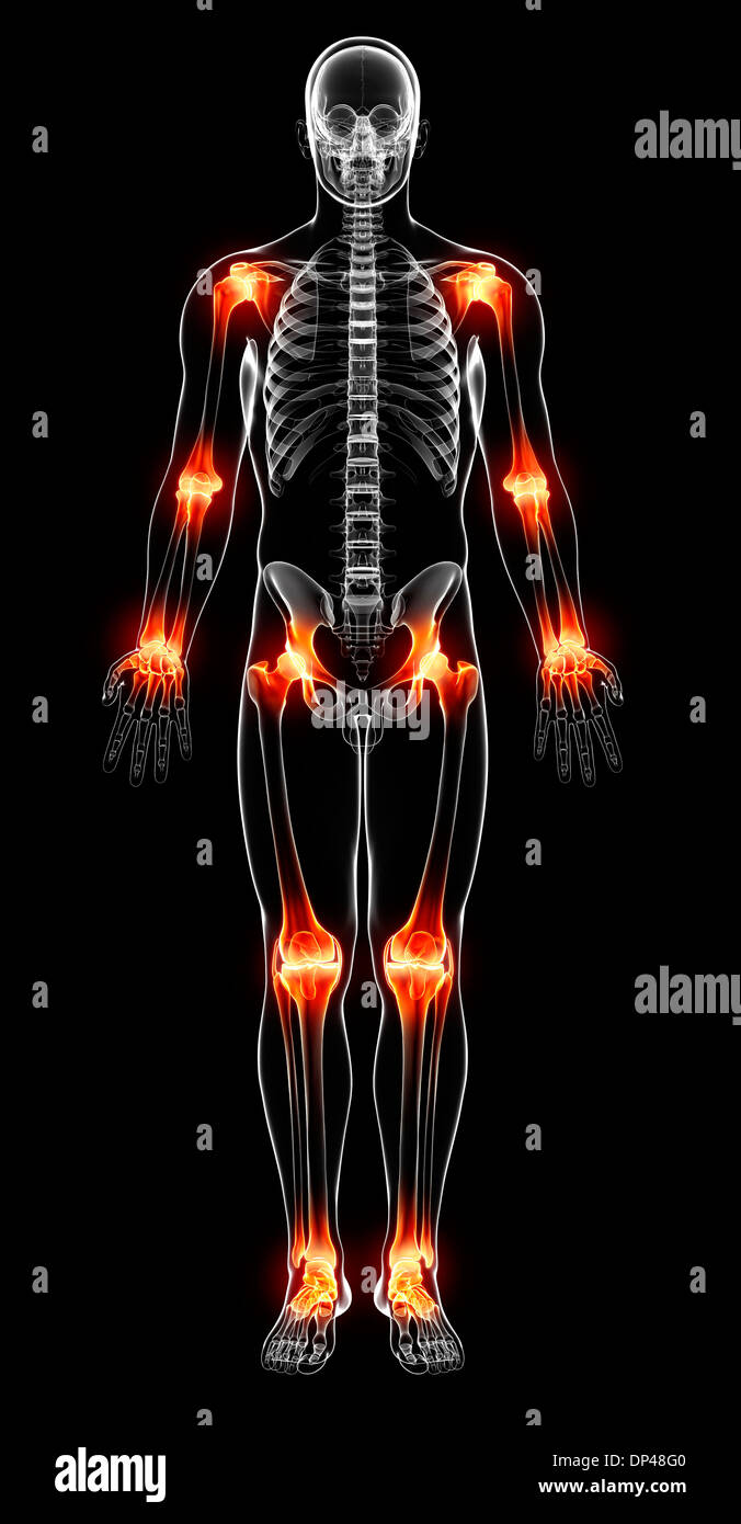 Joint pain, artwork Stock Photo - Alamy