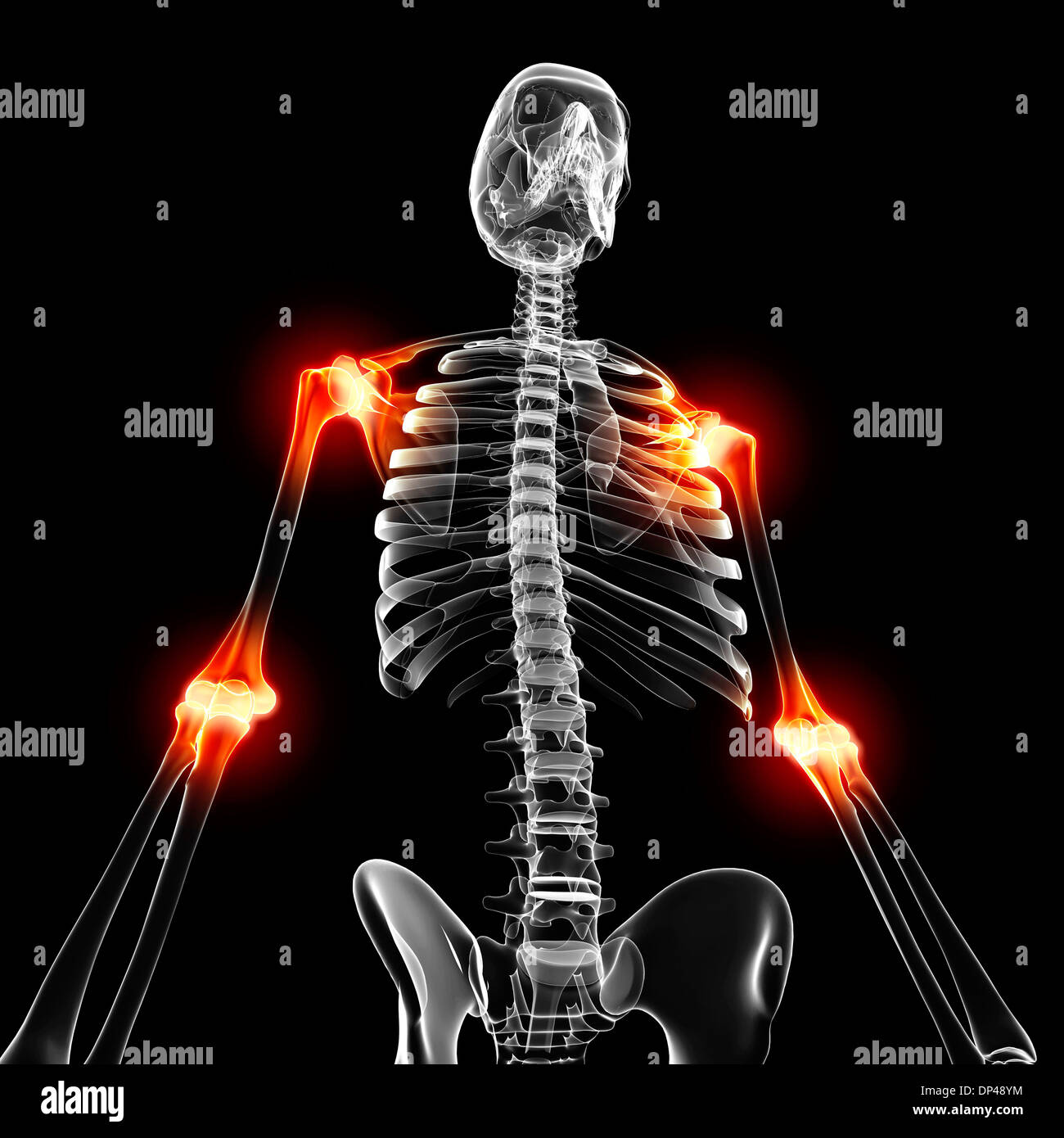 Joint pain, artwork Stock Photo - Alamy