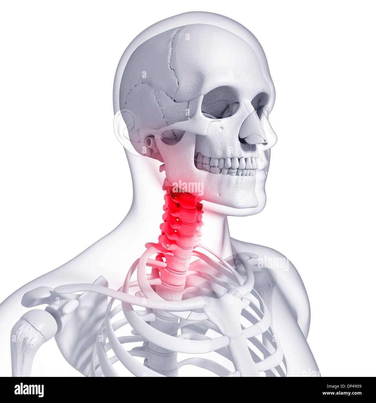 Neck pain inflammation Cut Out Stock Images & Pictures - Alamy