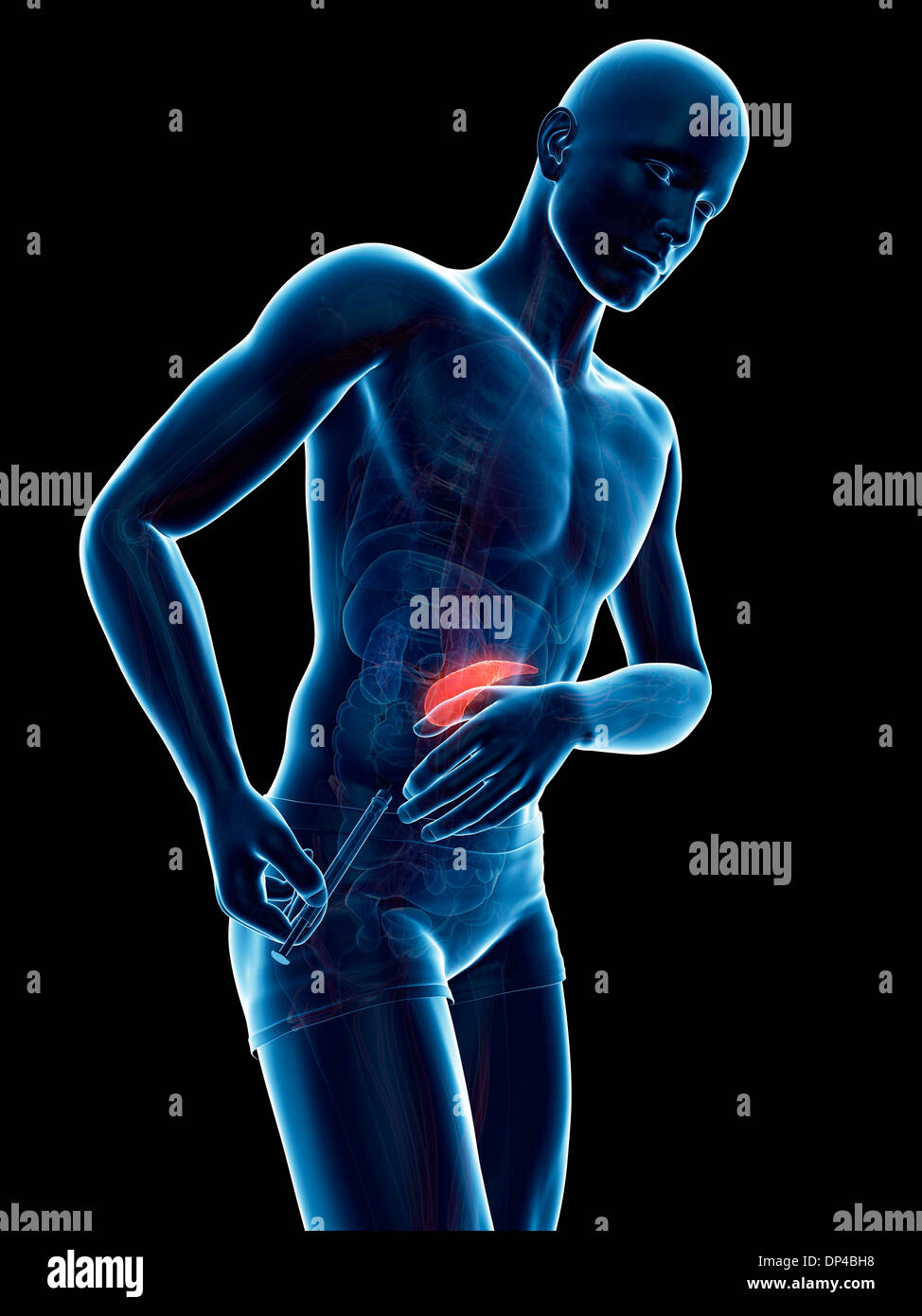 Insulin human injection hi-res stock photography and images - Alamy