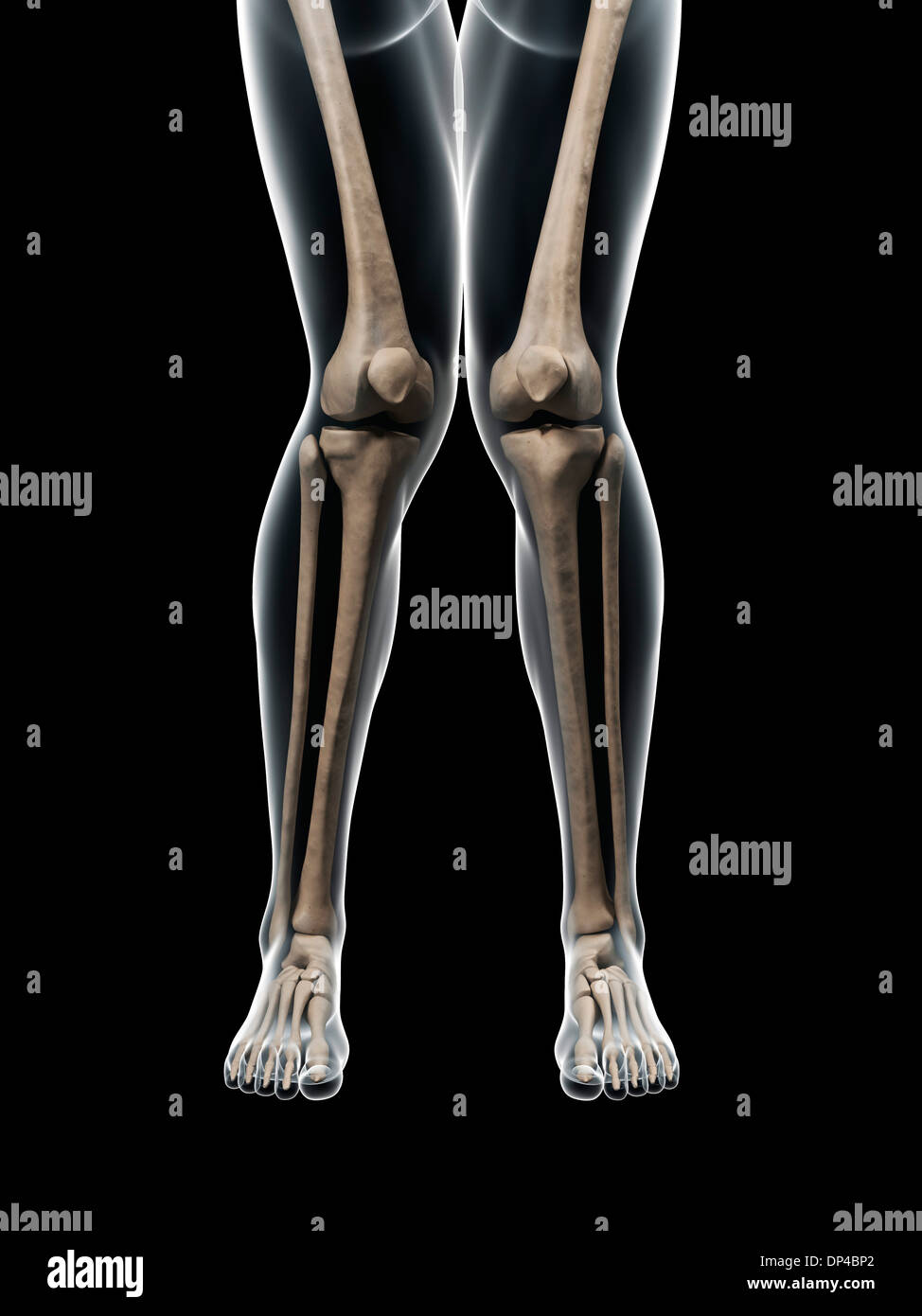 Knock knee, artwork Stock Photo - Alamy