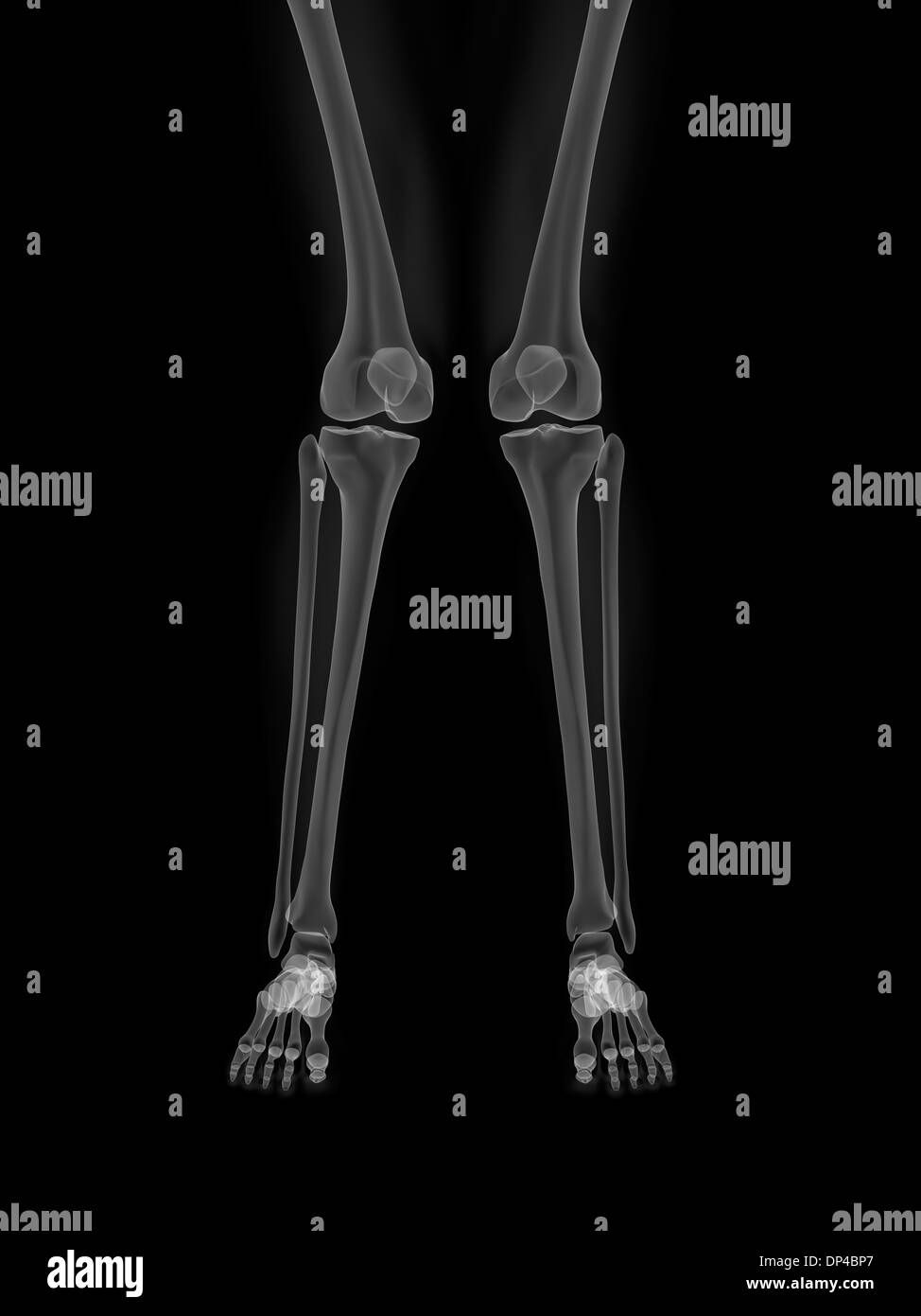 Knock knee, artwork Stock Photo - Alamy