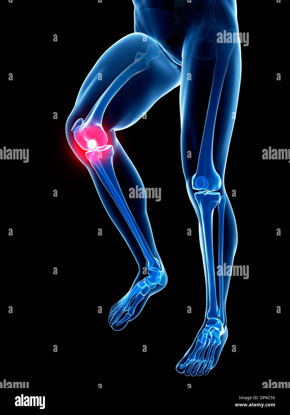 Knee pain, conceptual artwork Stock Photo - Alamy