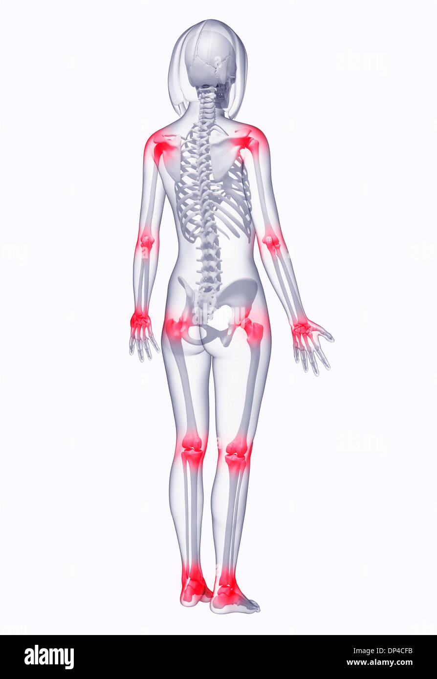 Joint pain female Cut Out Stock Images & Pictures - Alamy