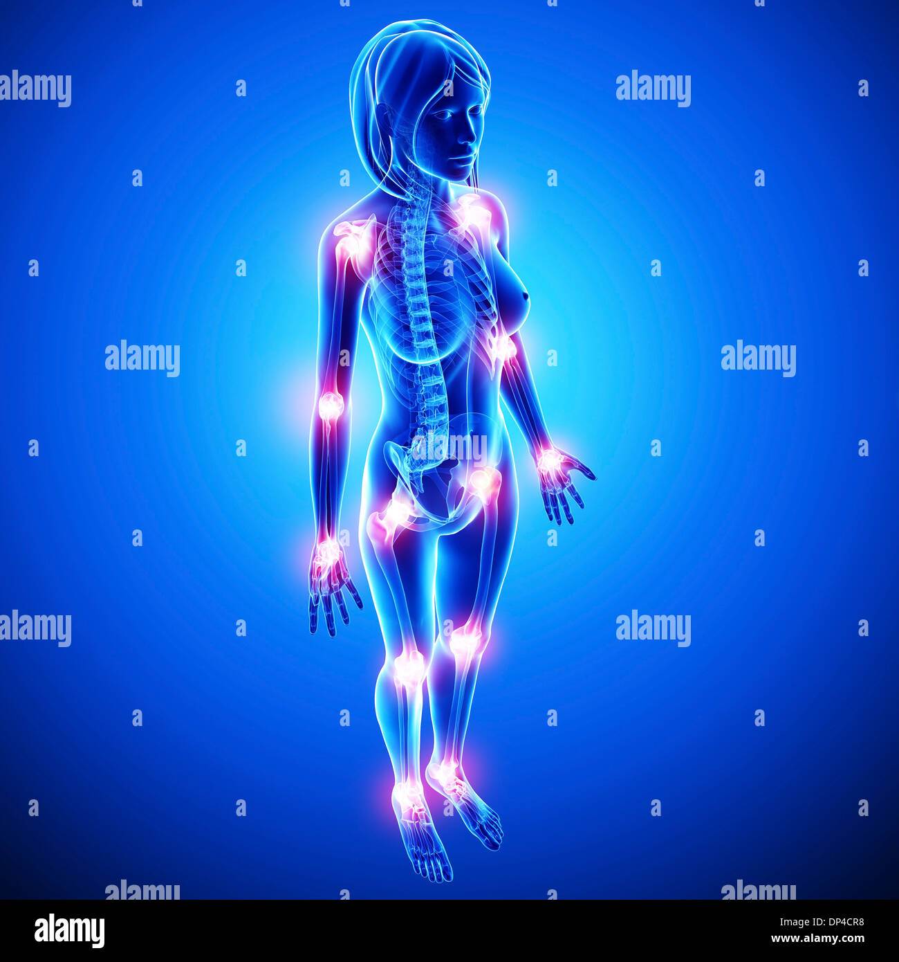 Joint pain, artwork Stock Photo - Alamy