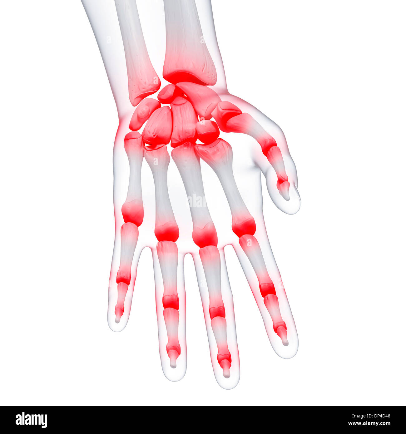 Hand pain, artwork Stock Photo - Alamy
