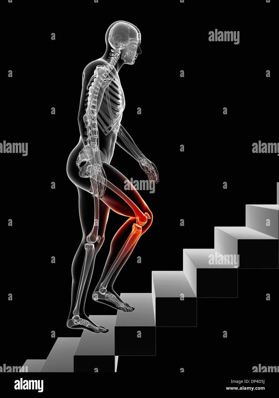 Knee pain, conceptual artwork Stock Photo - Alamy