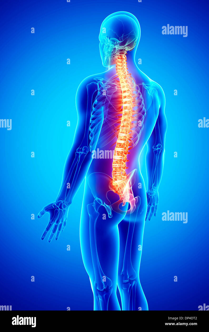 Back pain, artwork Stock Photo - Alamy