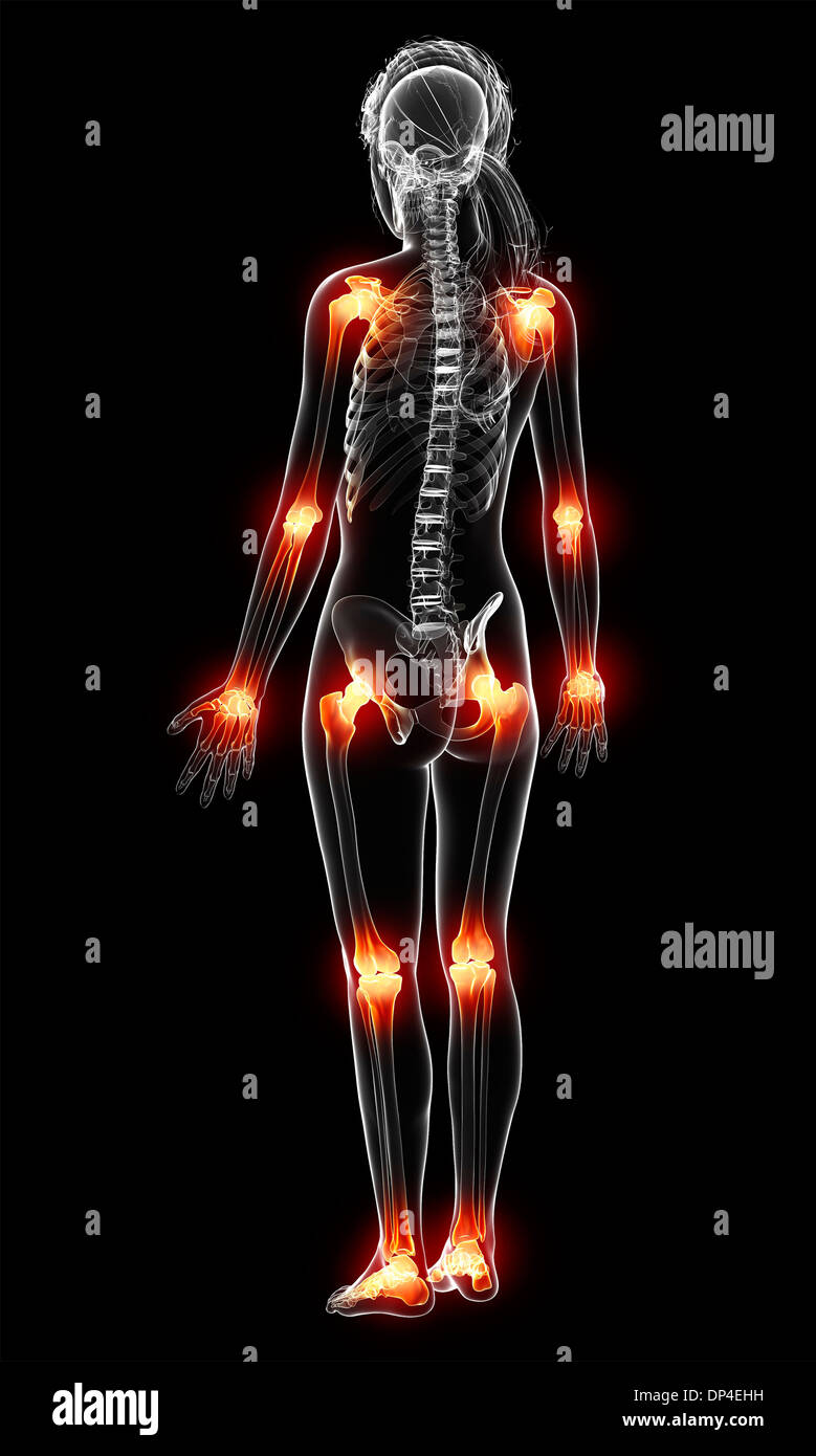 Joint pain, artwork Stock Photo - Alamy