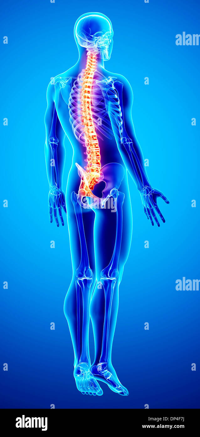 Back pain, artwork Stock Photo - Alamy