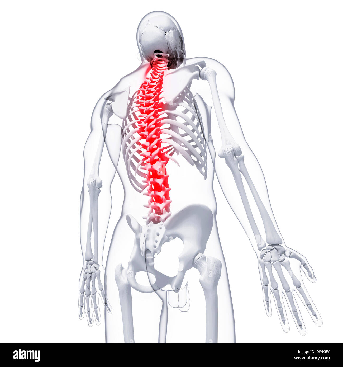 Back pain, artwork Stock Photo - Alamy
