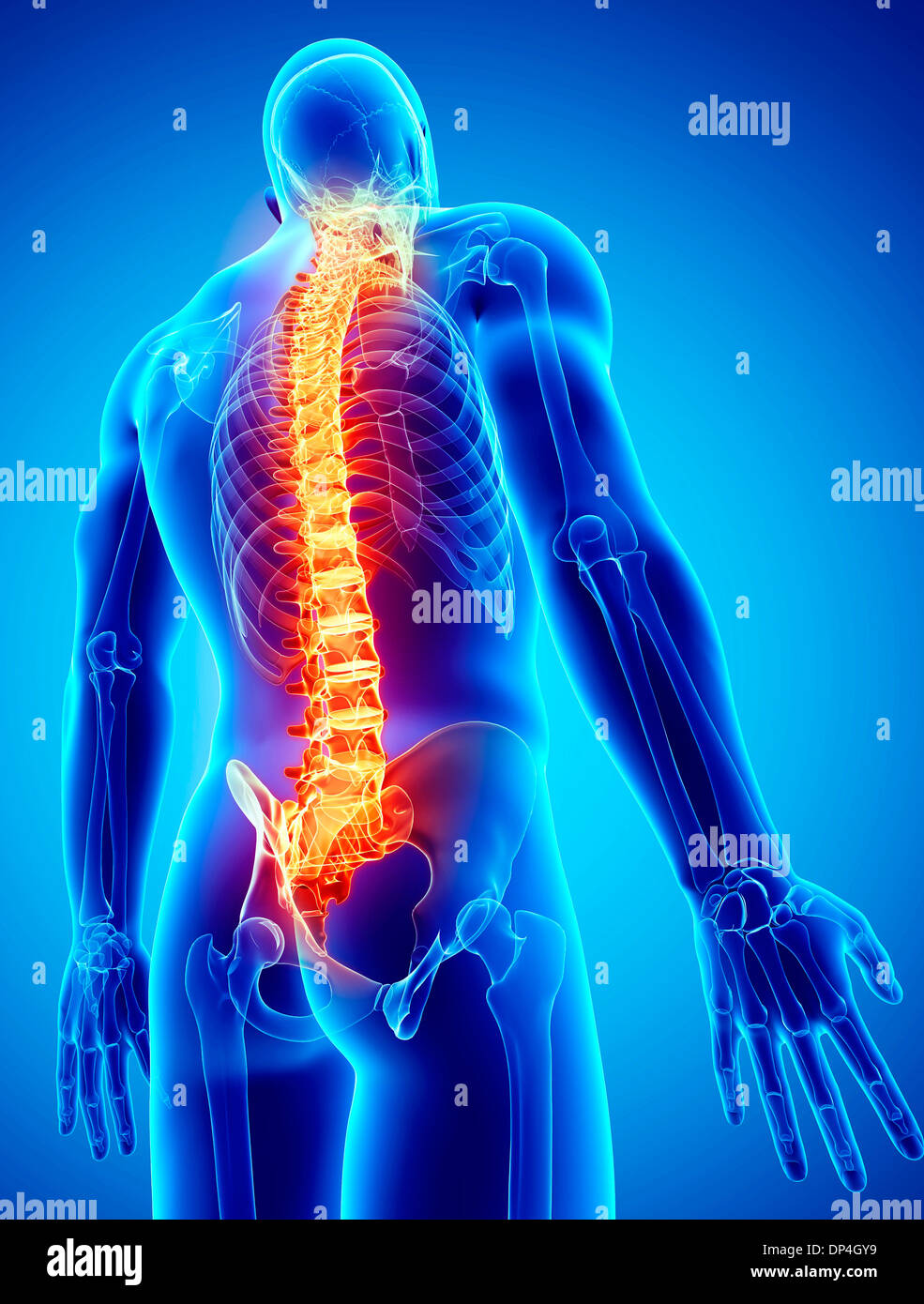 Back pain, artwork Stock Photo - Alamy