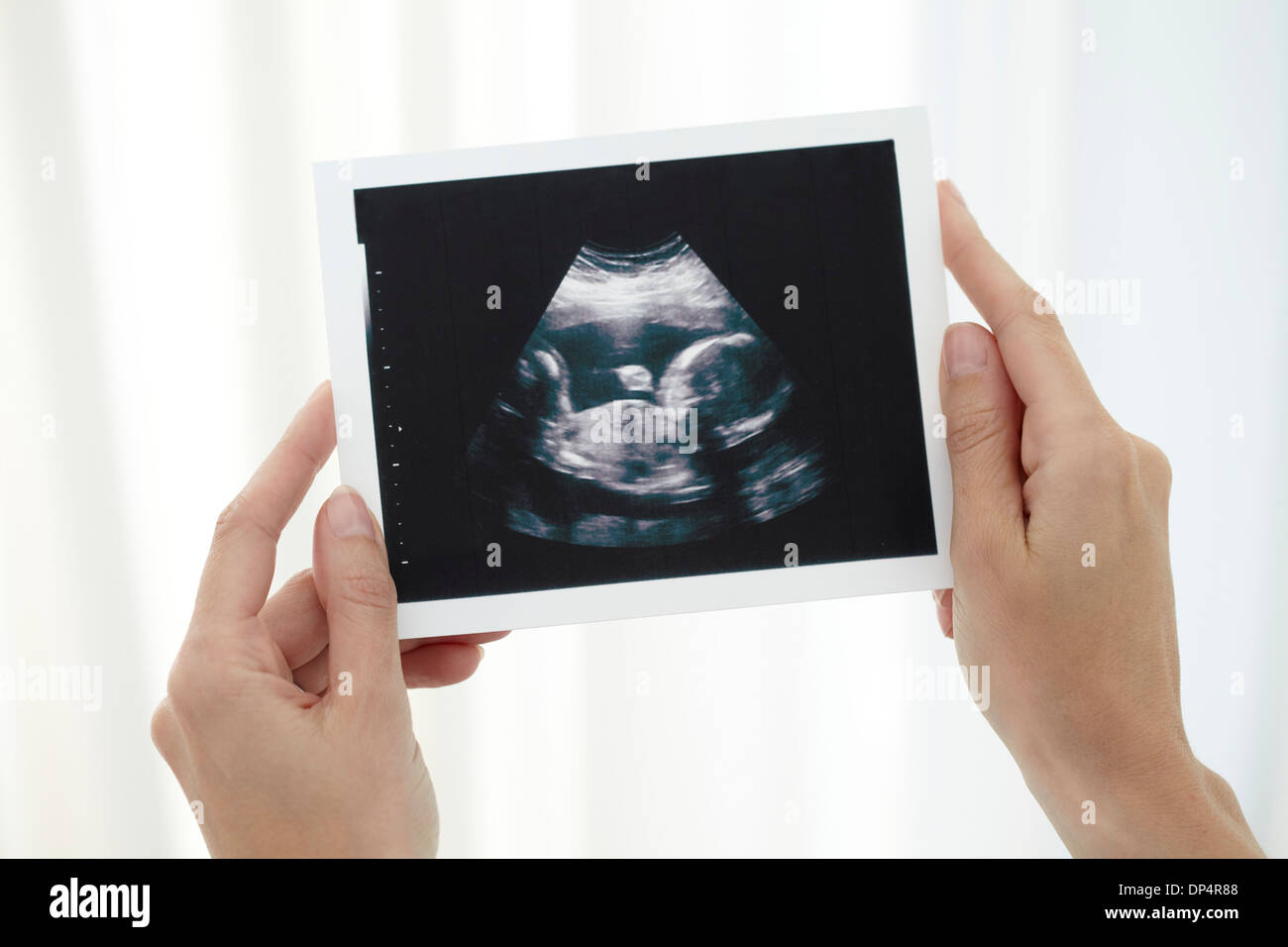 Baby Scan High Resolution Stock Photography and Images - Alamy