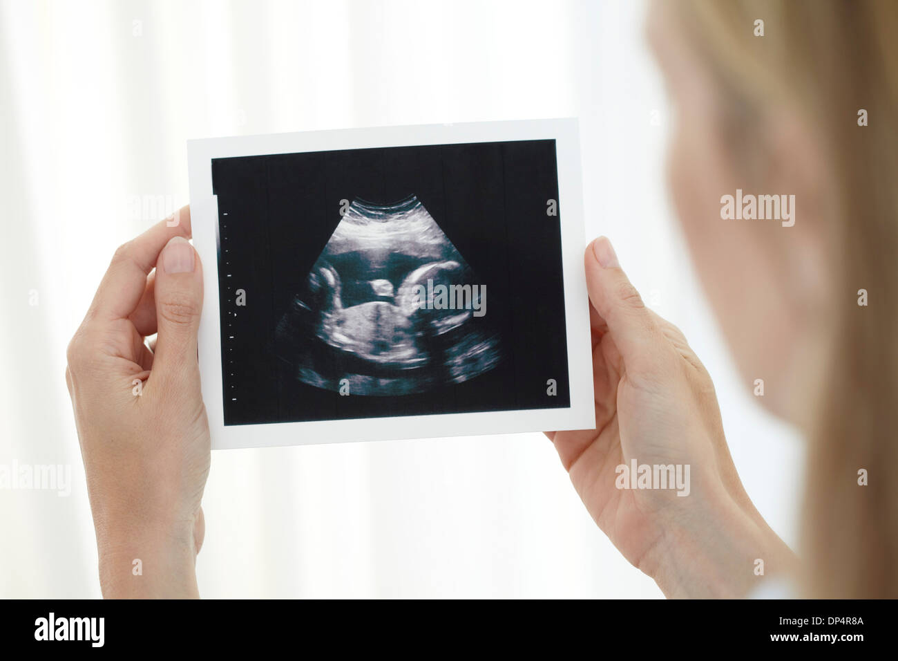 Baby growth scan hi-res stock photography and images - Alamy