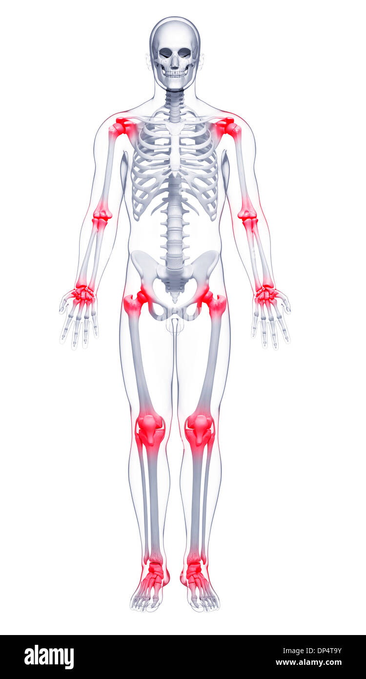 Abnormal joint Cut Out Stock Images & Pictures - Alamy