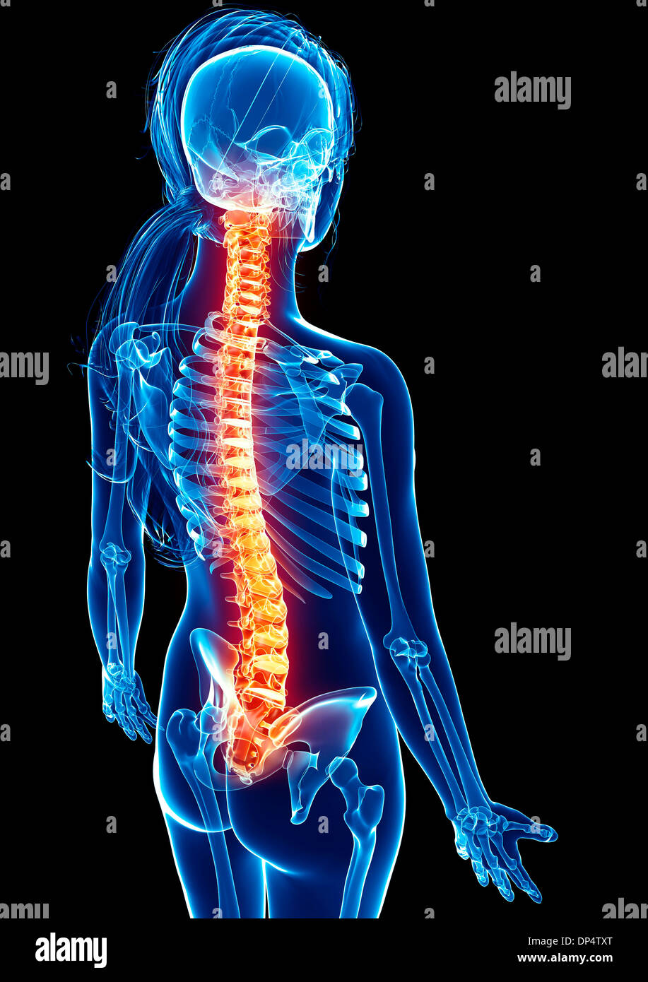 Back pain, artwork Stock Photo - Alamy