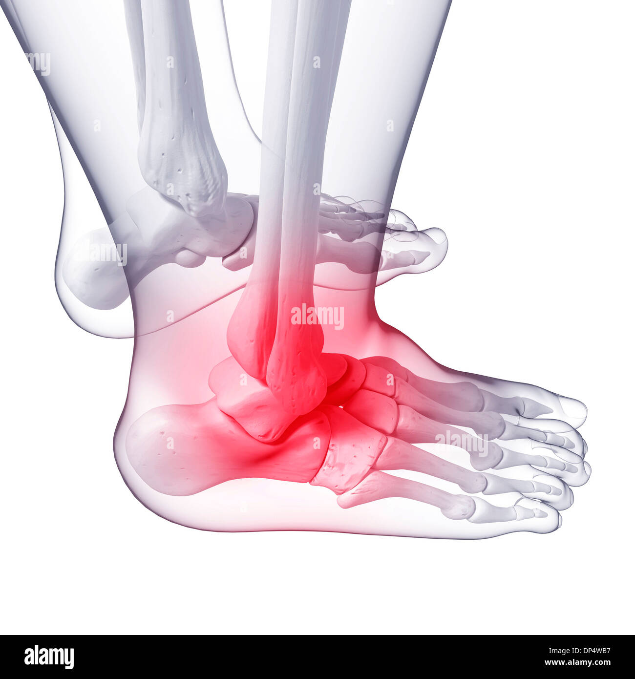 Foot pain, artwork Stock Photo - Alamy