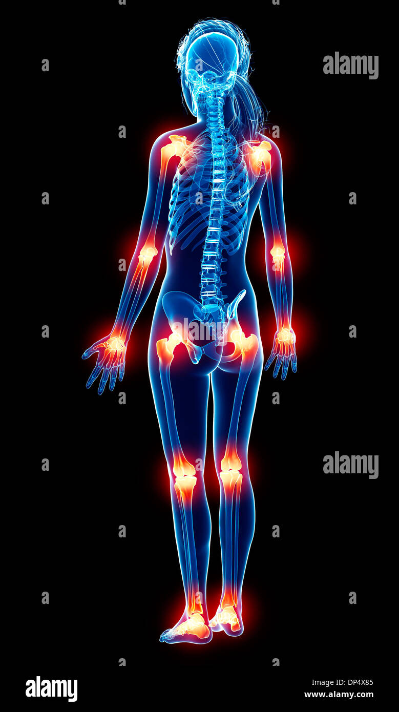 Joint pain, artwork Stock Photo - Alamy