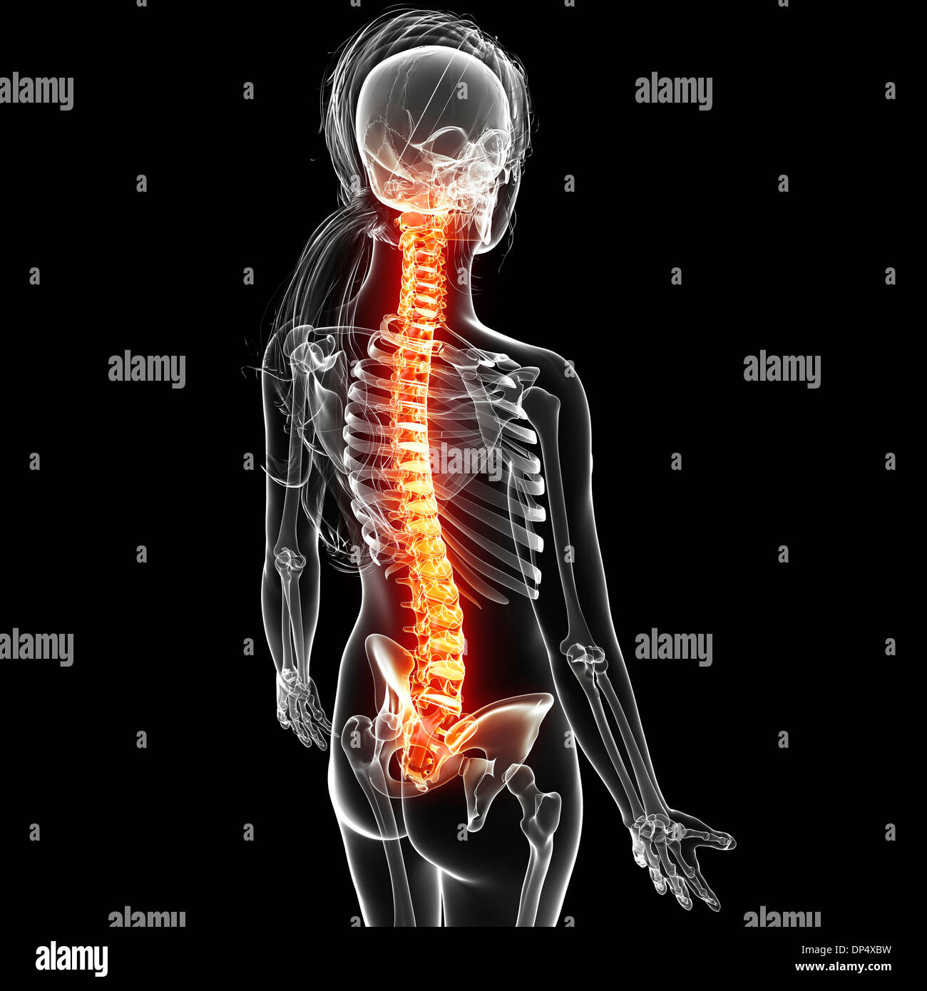 Back pain, artwork Stock Photo - Alamy