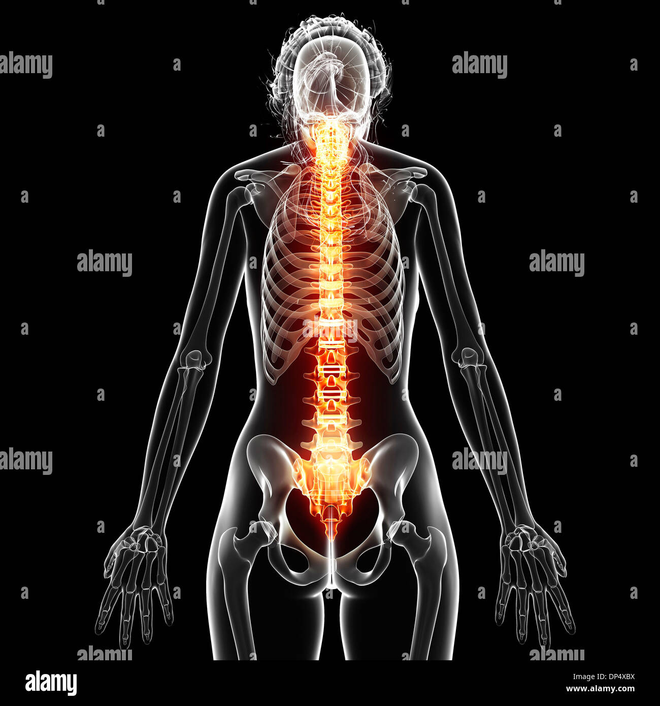 Back pain, artwork Stock Photo - Alamy