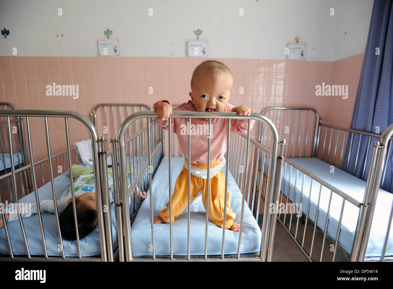 Birth deformed hi-res stock photography and images - Alamy