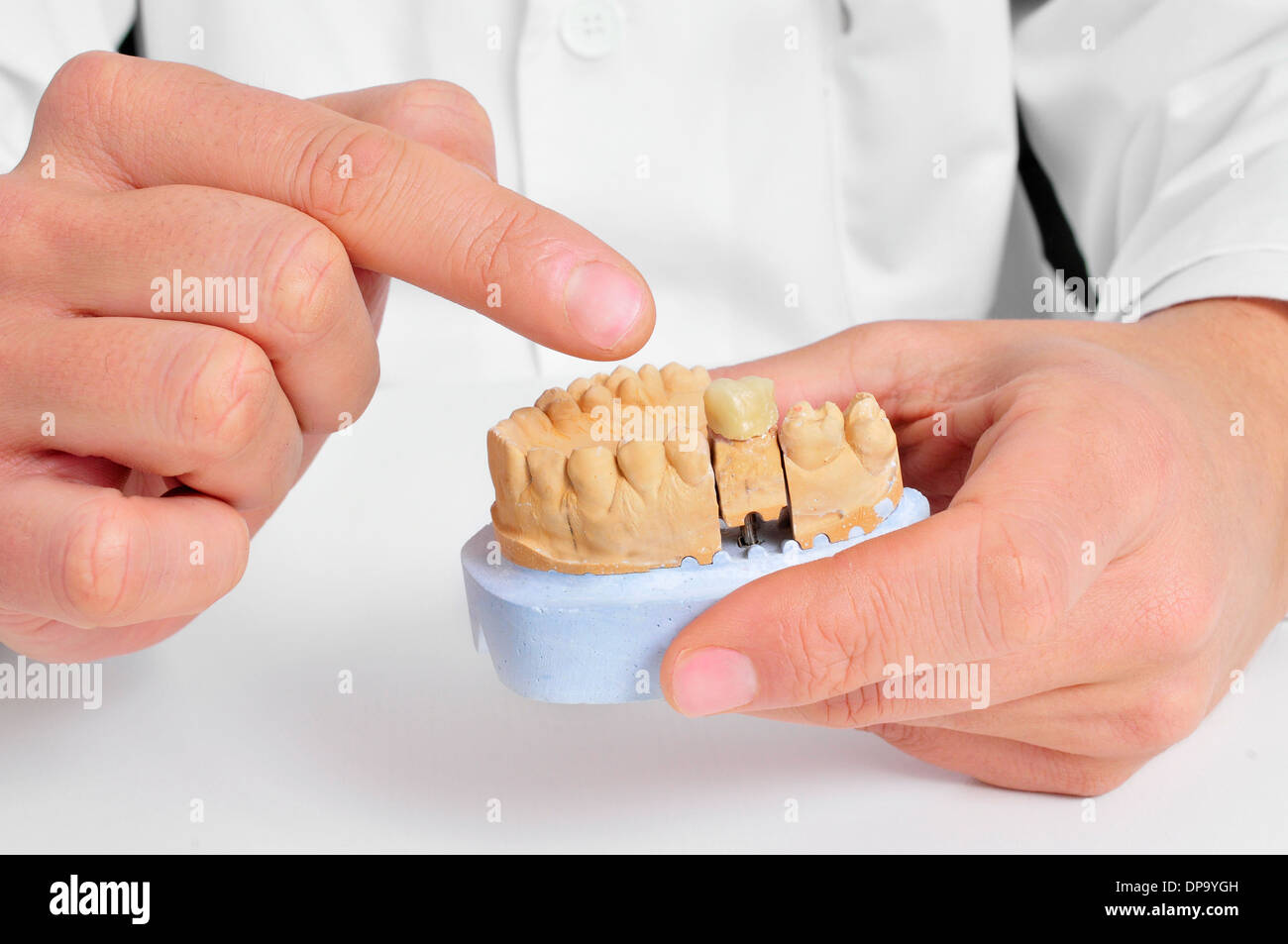 a dentist showing pointing a prosthesis in a dental mould Stock Photo ...