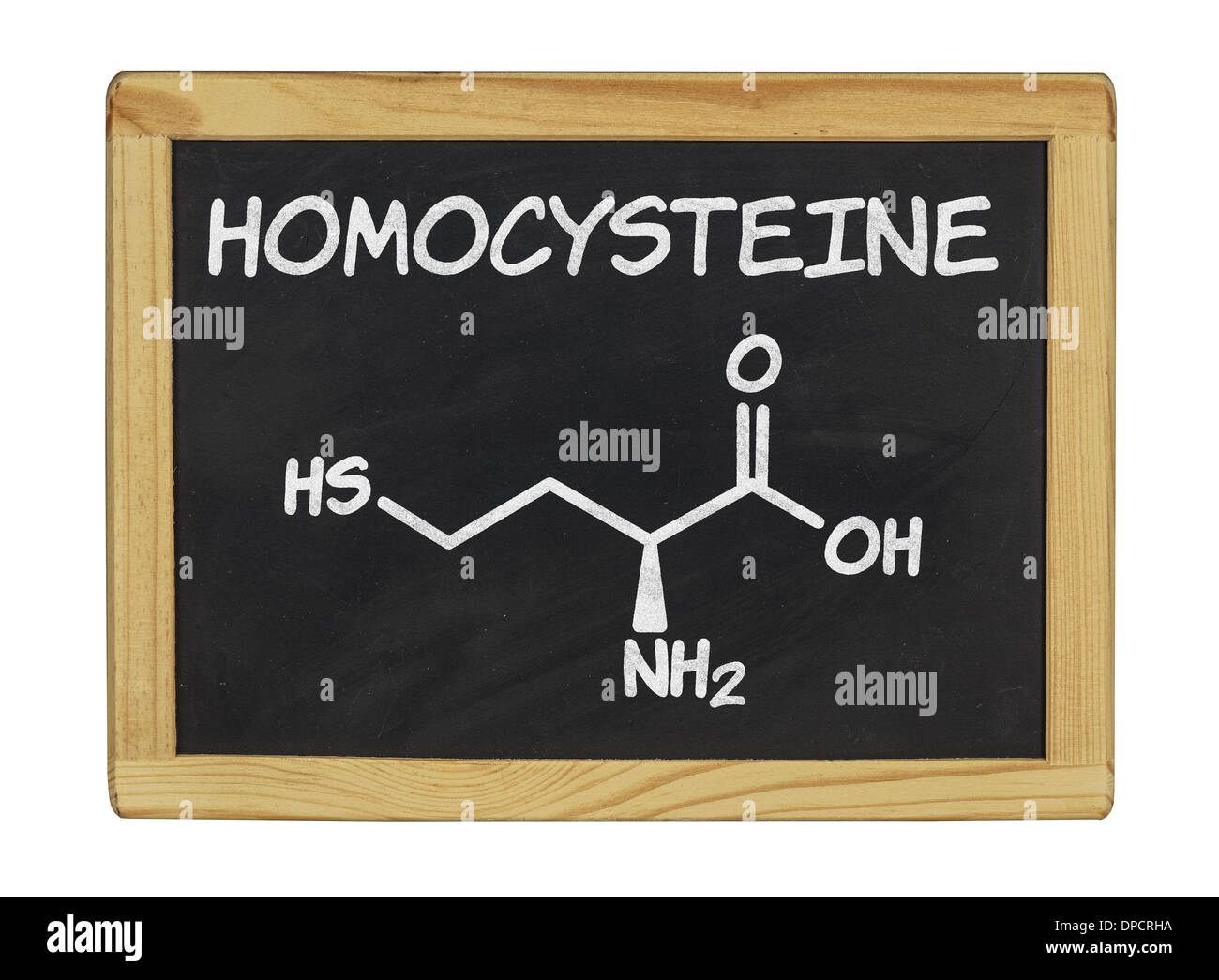 chemical formula of homocystein on a blackboard Stock Photo - Alamy