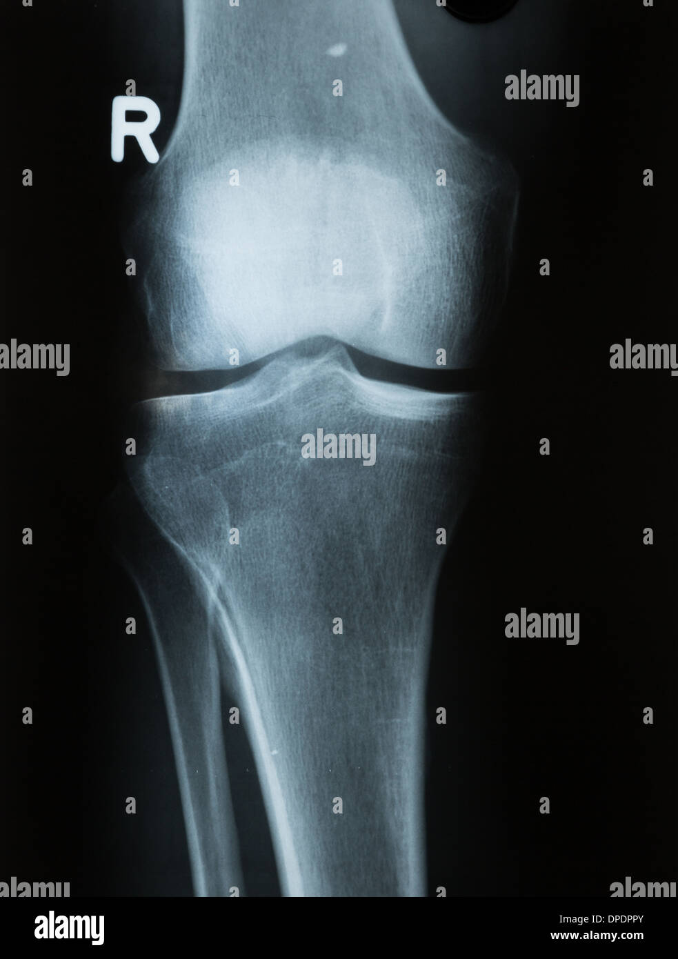 Human knee ligaments hi-res stock photography and images - Alamy