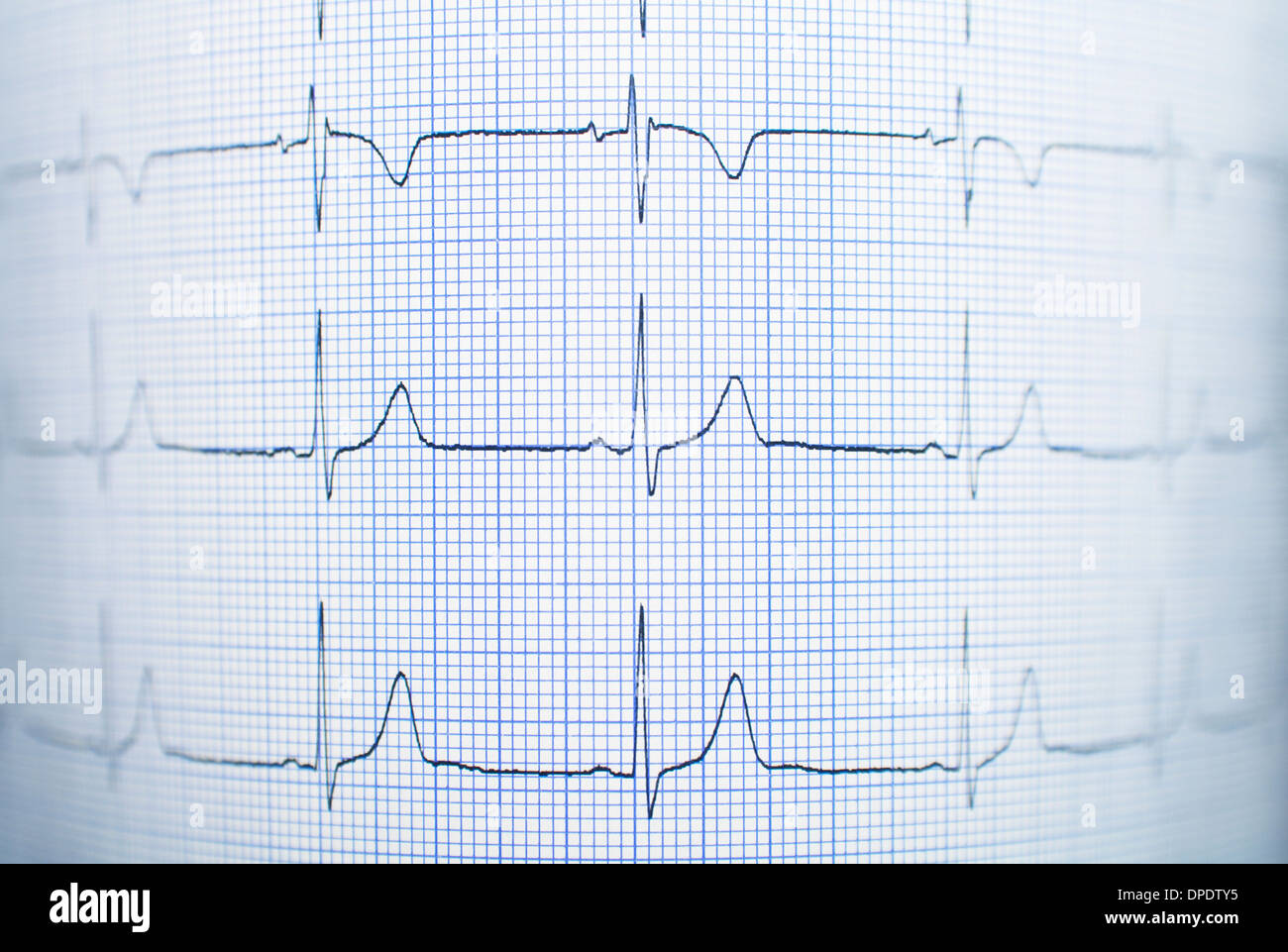 Electrocardiogram Stock Photos & Electrocardiogram Stock Images - Alamy