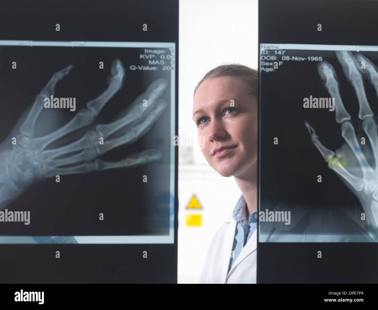 Doctor viewing xrays hi-res stock photography and images - Alamy