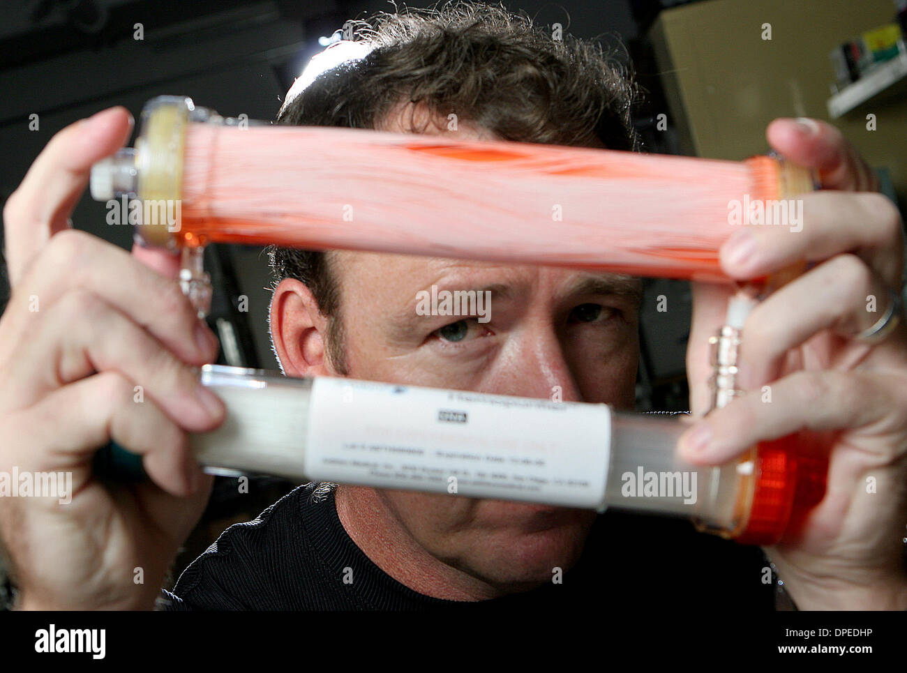 Dialysis filters hi-res stock photography and images - Alamy