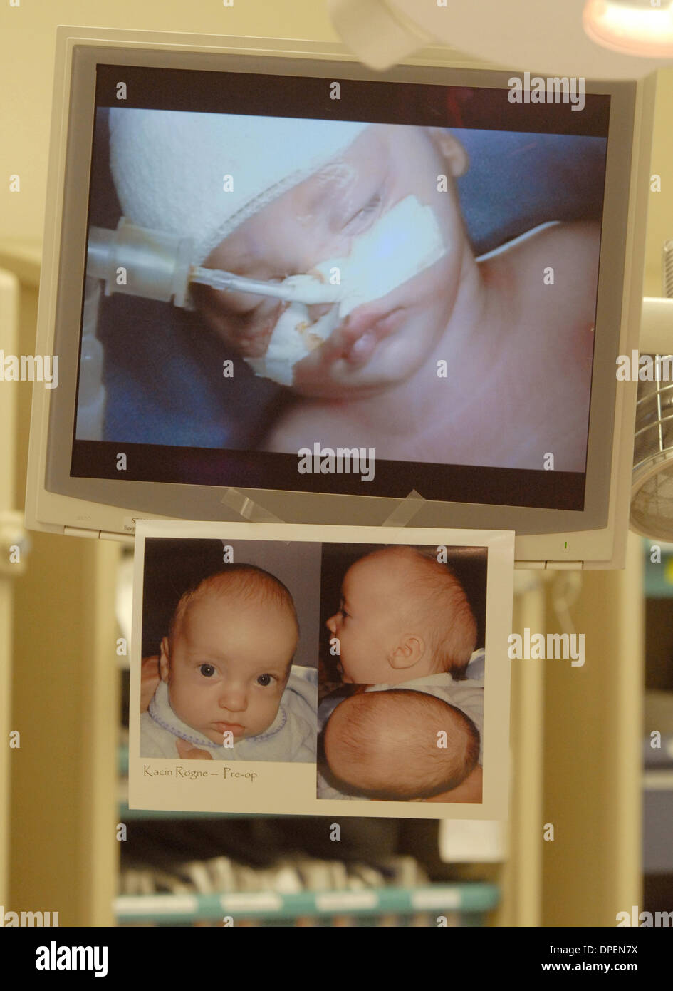 A photo of 11 week-old Kacin Rogne is taped to a monitor that shows ...