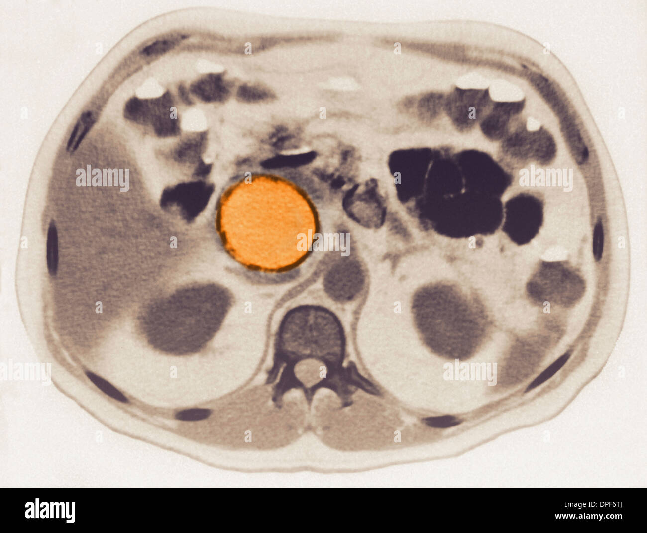 Human stomach mri hi-res stock photography and images - Alamy