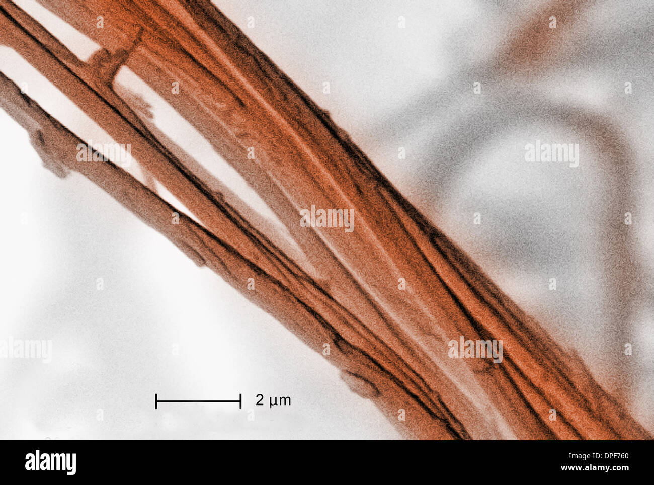 Scanning electron micrograph asbestos hi-res stock photography and ...