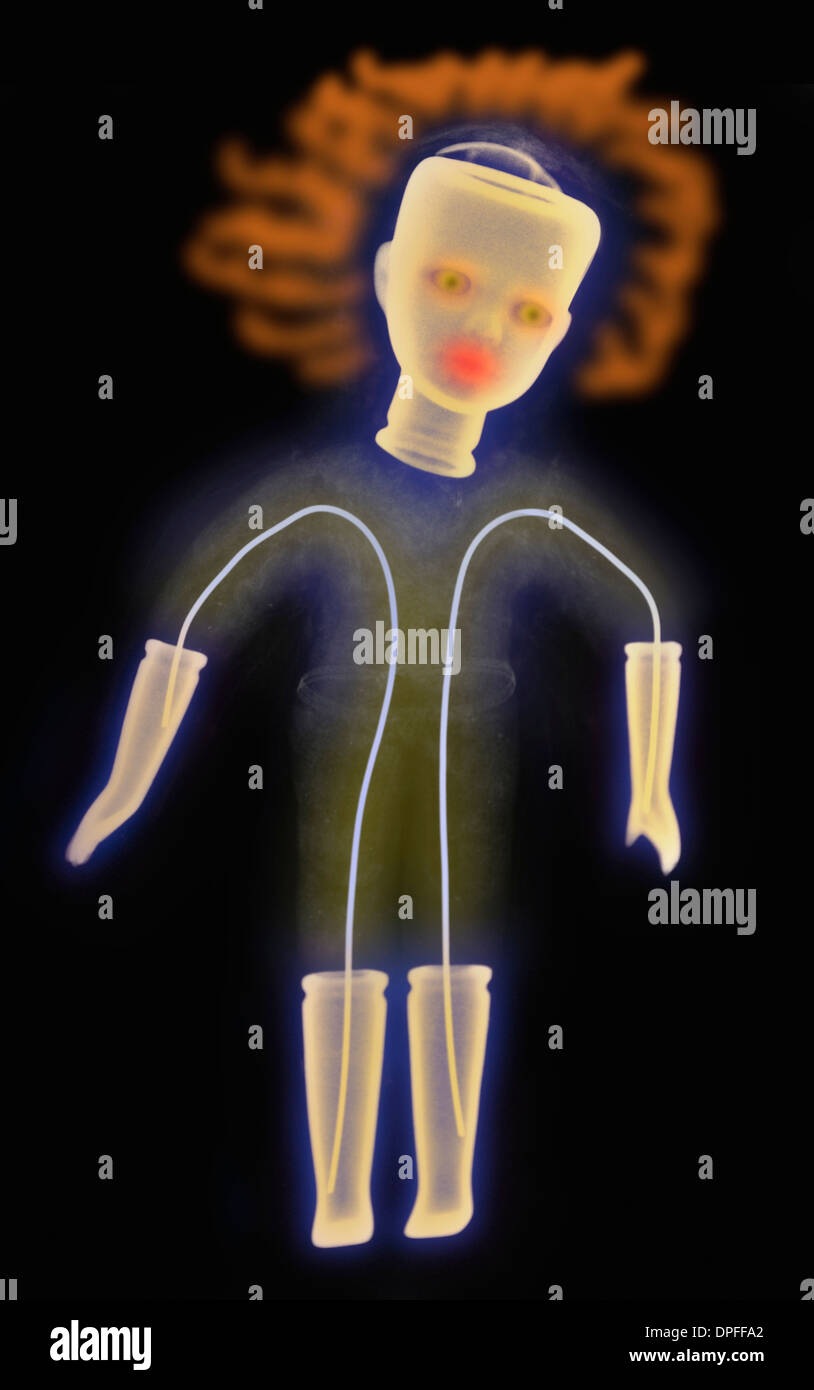colorized x-ray of a doll Stock Photo - Alamy