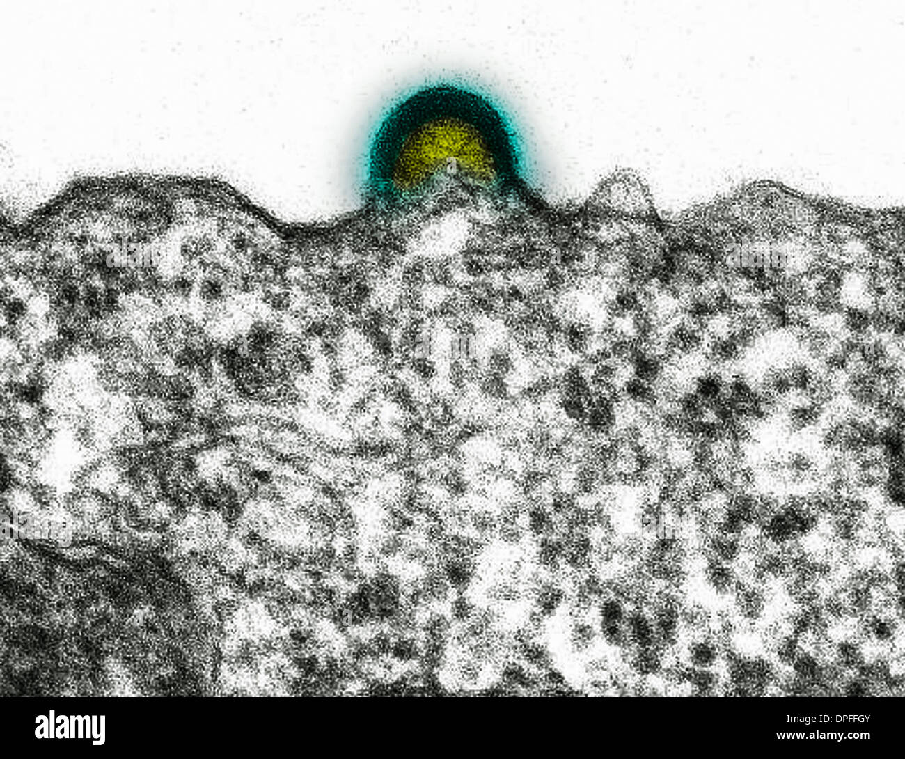 TEM of AIDS, HIV-1, budding from a lymphocyte Stock Photo - Alamy