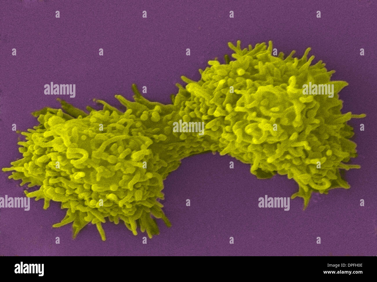SEM of Acanthamoeba polyphaga protozoa Stock Photo - Alamy