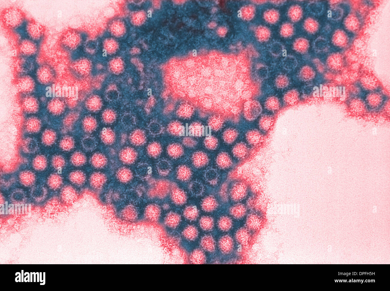 EM image of feline calicivirus (FCV Stock Photo - Alamy