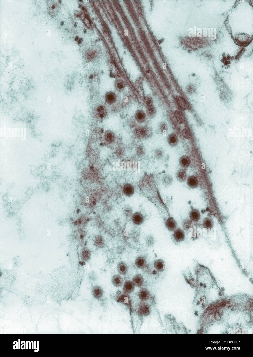 TEM of Colorado tick fever virus (CTFV Stock Photo - Alamy