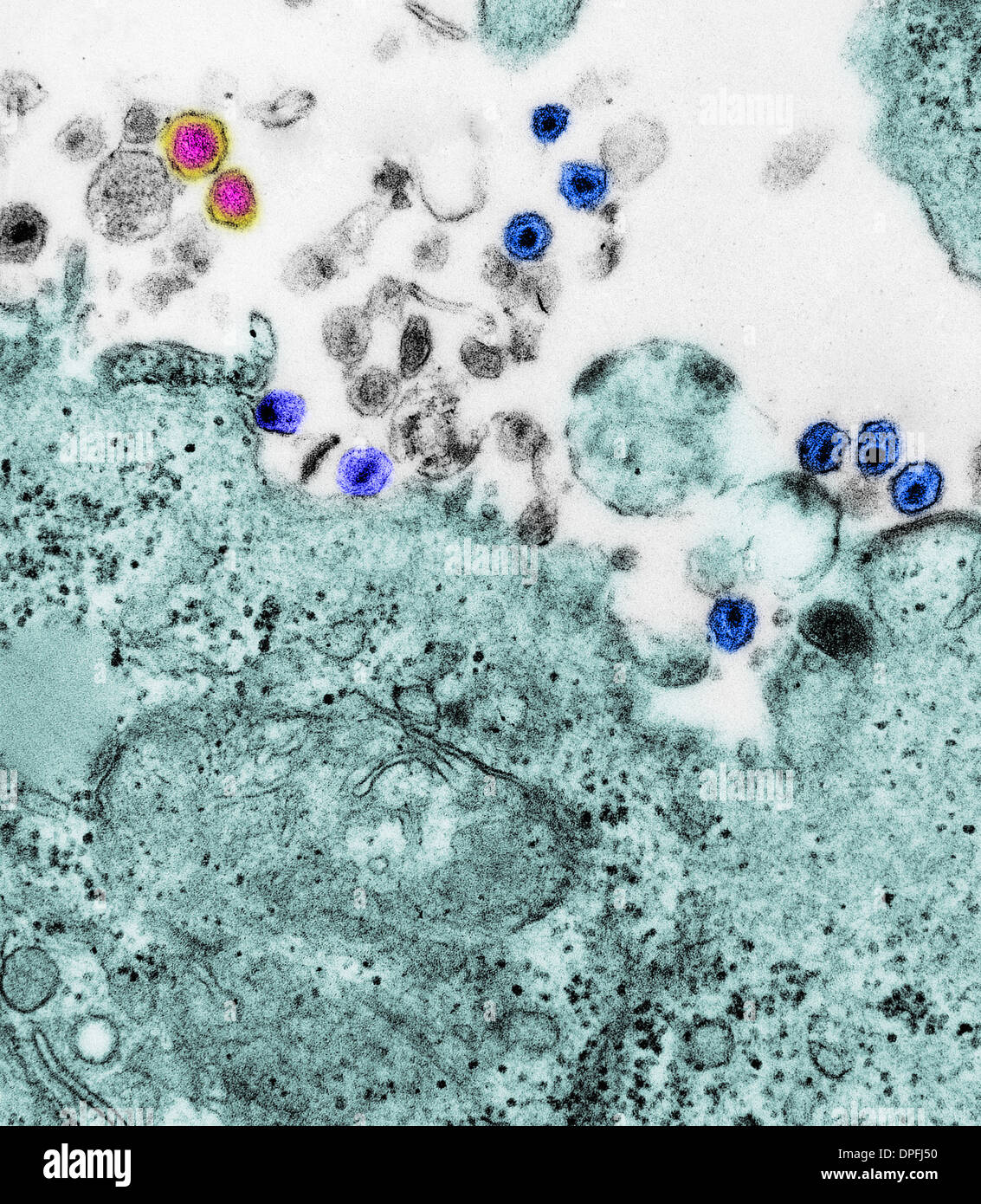 TEM of HTLV I and HIV viruses Stock Photo - Alamy