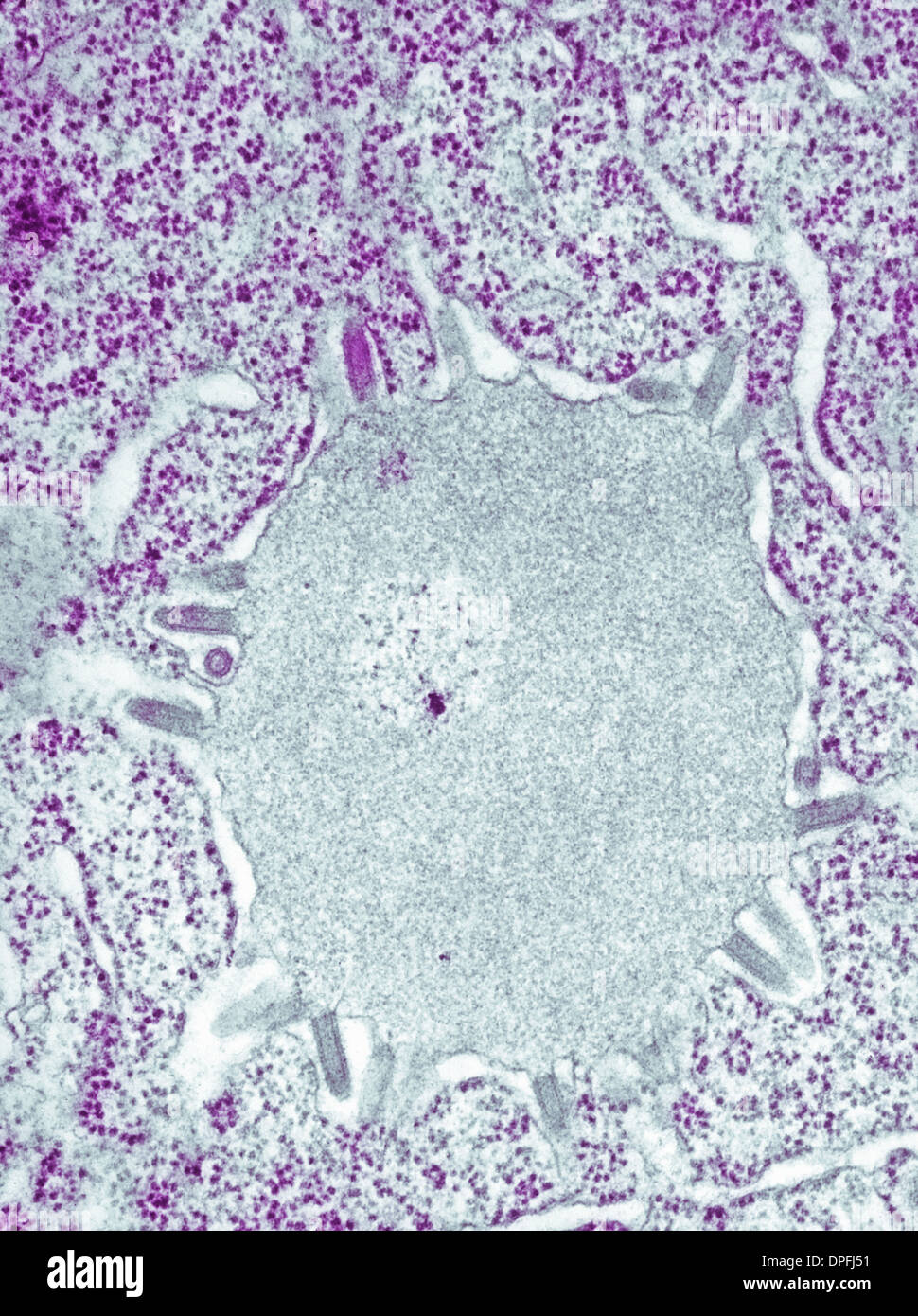 TEM of Lagos bat virus (LBV Stock Photo - Alamy