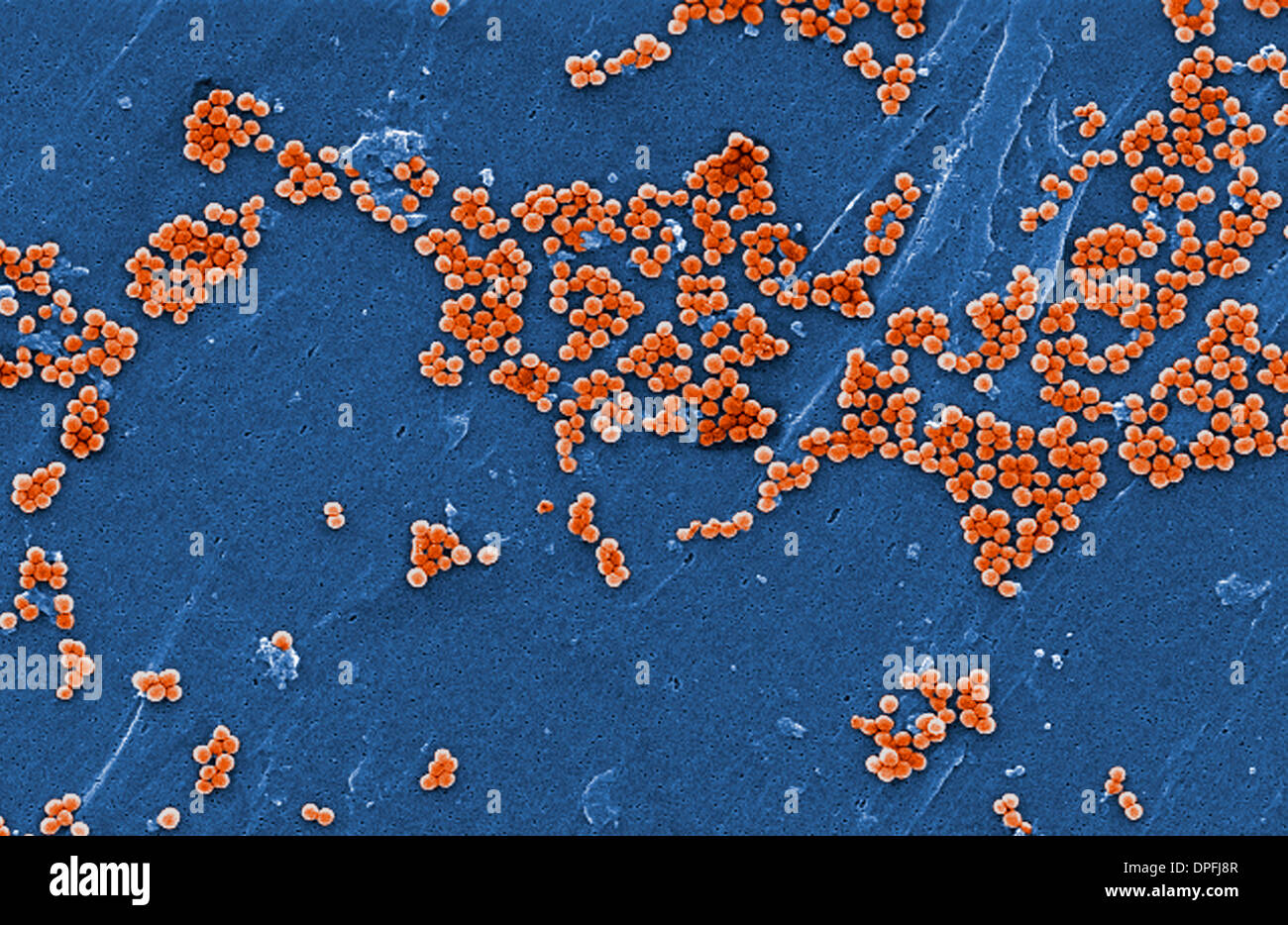 Aureus staphylococcus sem hi-res stock photography and images - Alamy