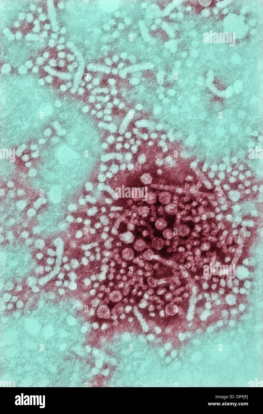 TEM, of hepatitis B virus Stock Photo - Alamy